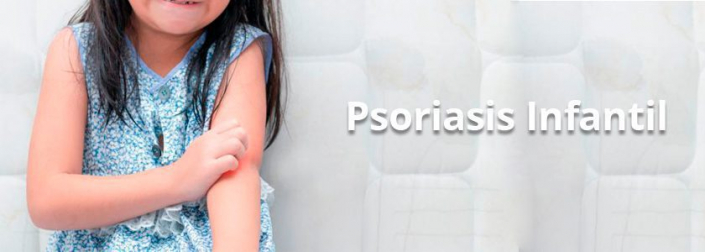 Psoriasis en la infancia... un reto de diagnóstico - Tecnosa