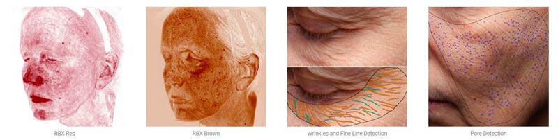 Ole-Imager_Captura - Tecnosa